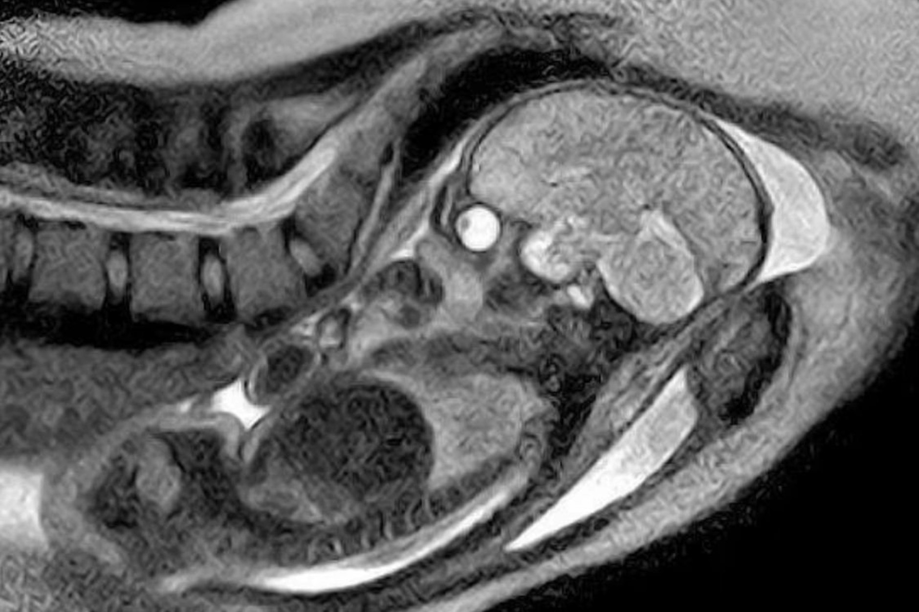 Krasse Ultraschallbilder: Diese Baby sehen aus wie Aliens!