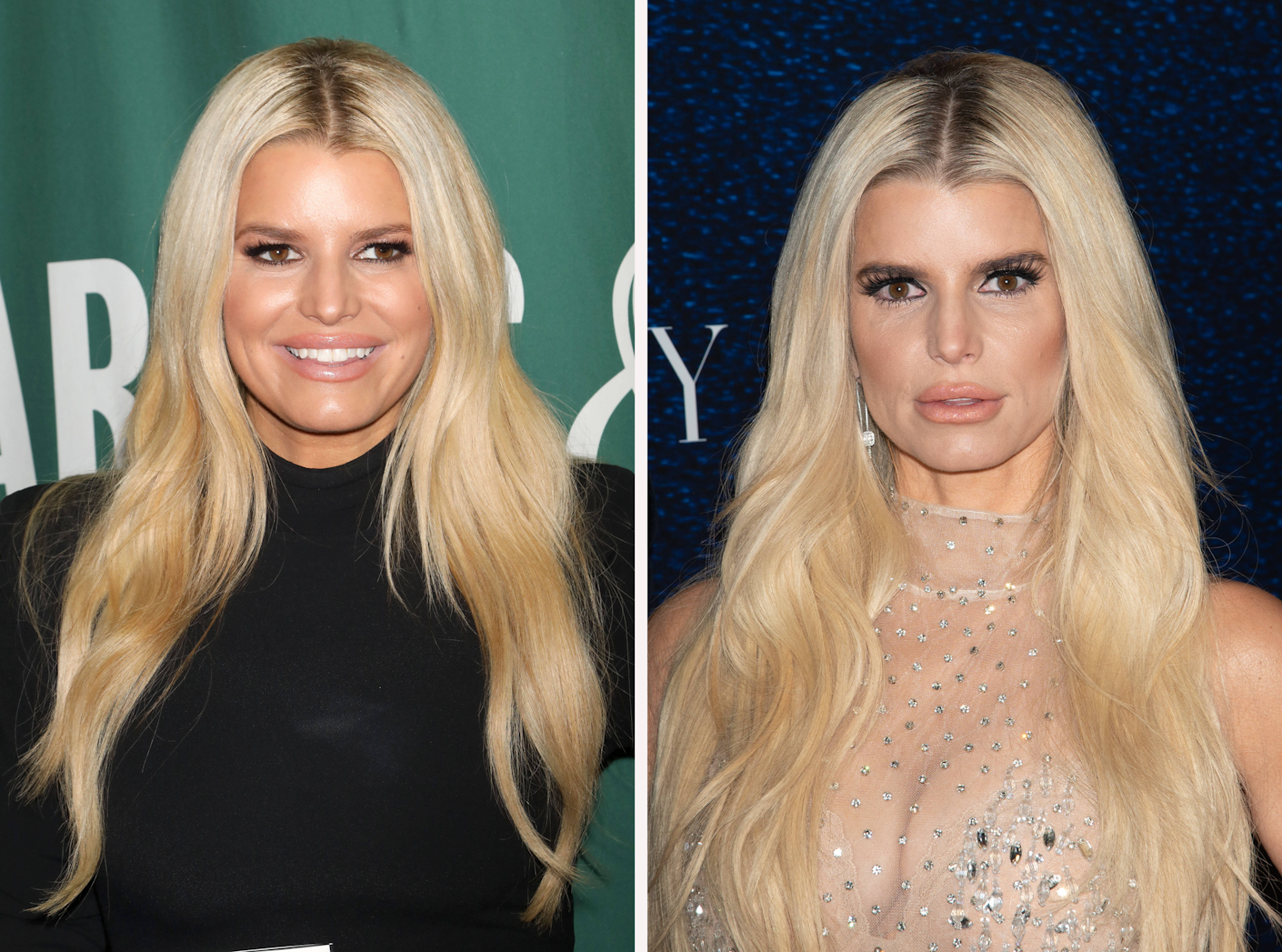 Robbie Williams, Jessica Simpson, Sharon Osbourne: Wie das Ozempic Face ...