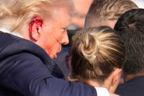 Attentat auf Trump: Rätselraten um den Ohr-Schuss: Wie kann DAS sein?