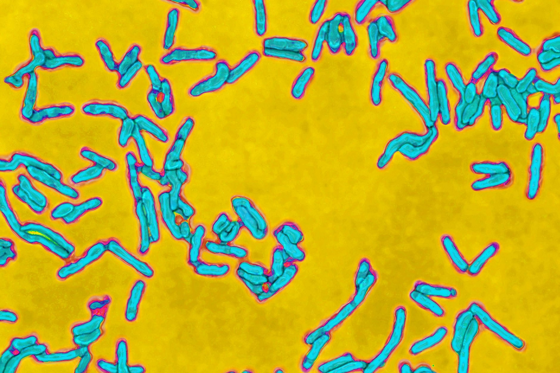 Nach Diphtherie-Tod eines Berliner Schülers: Antworten auf die ...