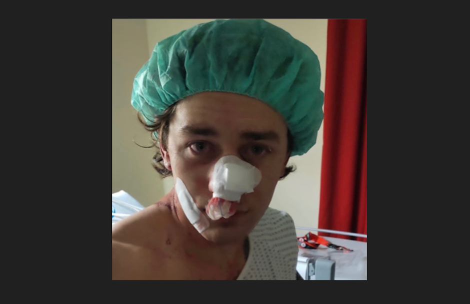 Messerattacke: John wollte Frauen helfen, jetzt braucht er selbst Hilfe